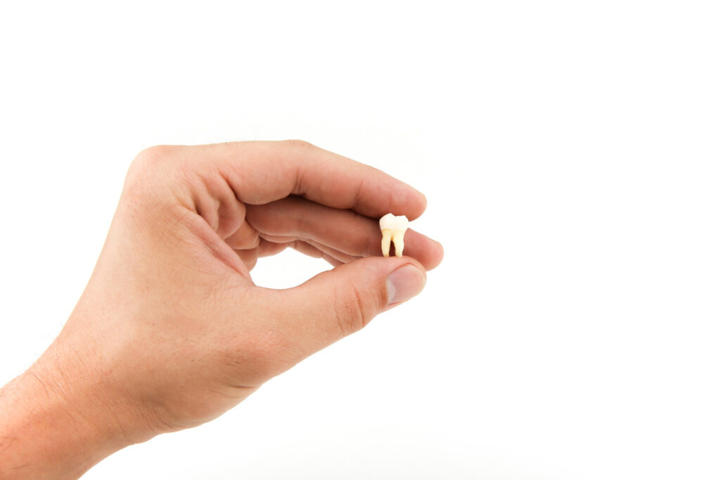 hand-holding-human-tooth-isolated-white | Natural Dentures & Implant Center